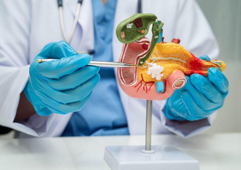Hepatobiliary, Pancreas & Liver Surgery |FVSA of Wisconsin
